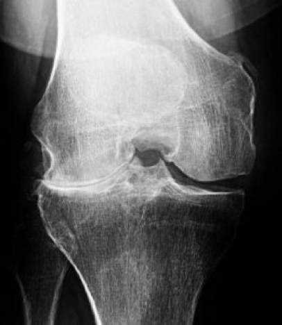 Bone on Bone - Ken Oder