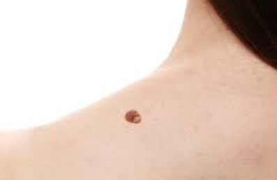 Mole Location - Ken Oder